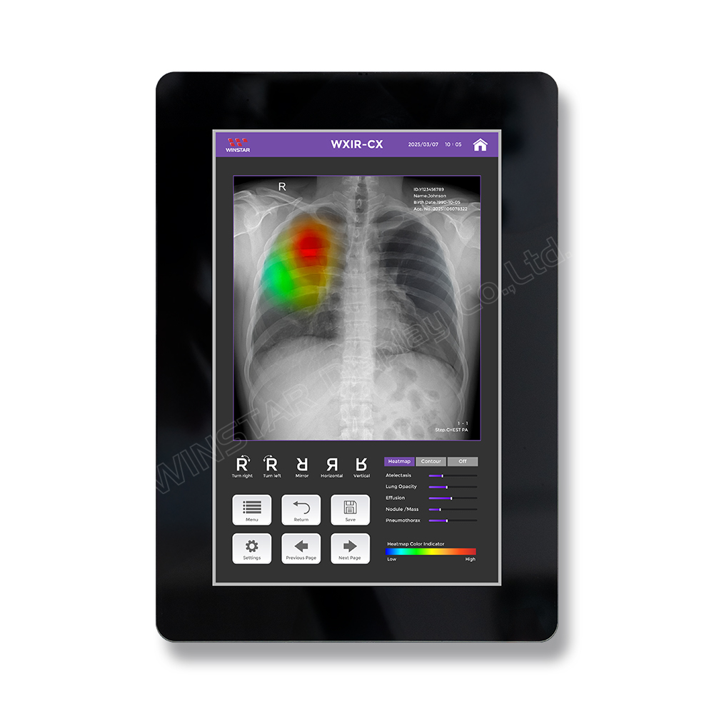 WF70D4SYAUMNG10-WSR / WF70D4SYAUMNG10# | TFT LCD Display | Winstar ...